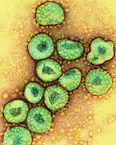 Information about Coronavirus (COVID-19) | Max Planck Institute of ... Information about Coronavirus (COVID-19) | Max Planck Institute of ...